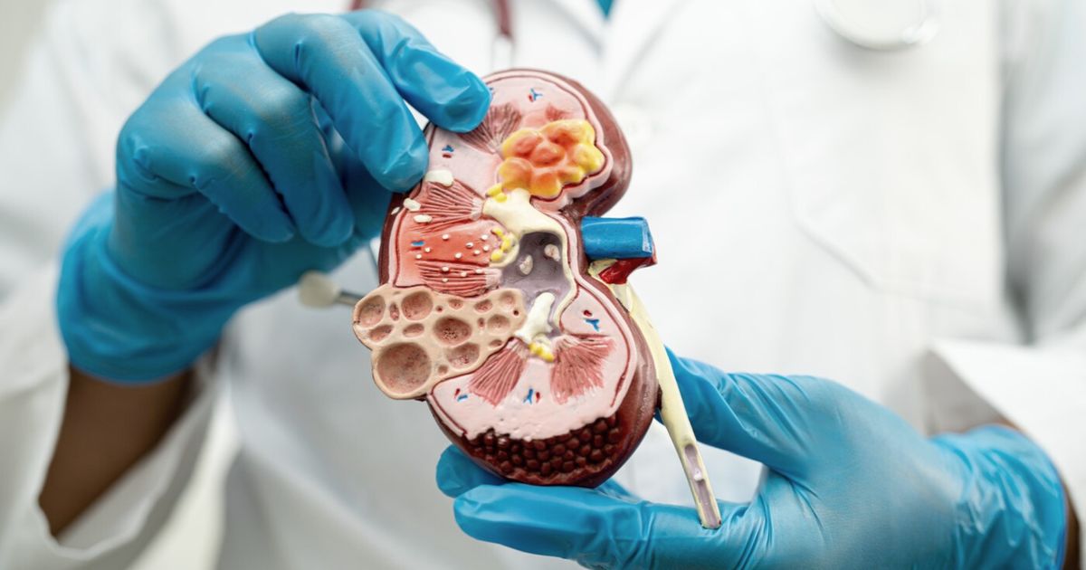 Neverjeten preboj v medicini: prvič uspešno presadili ledvico, ki je ...