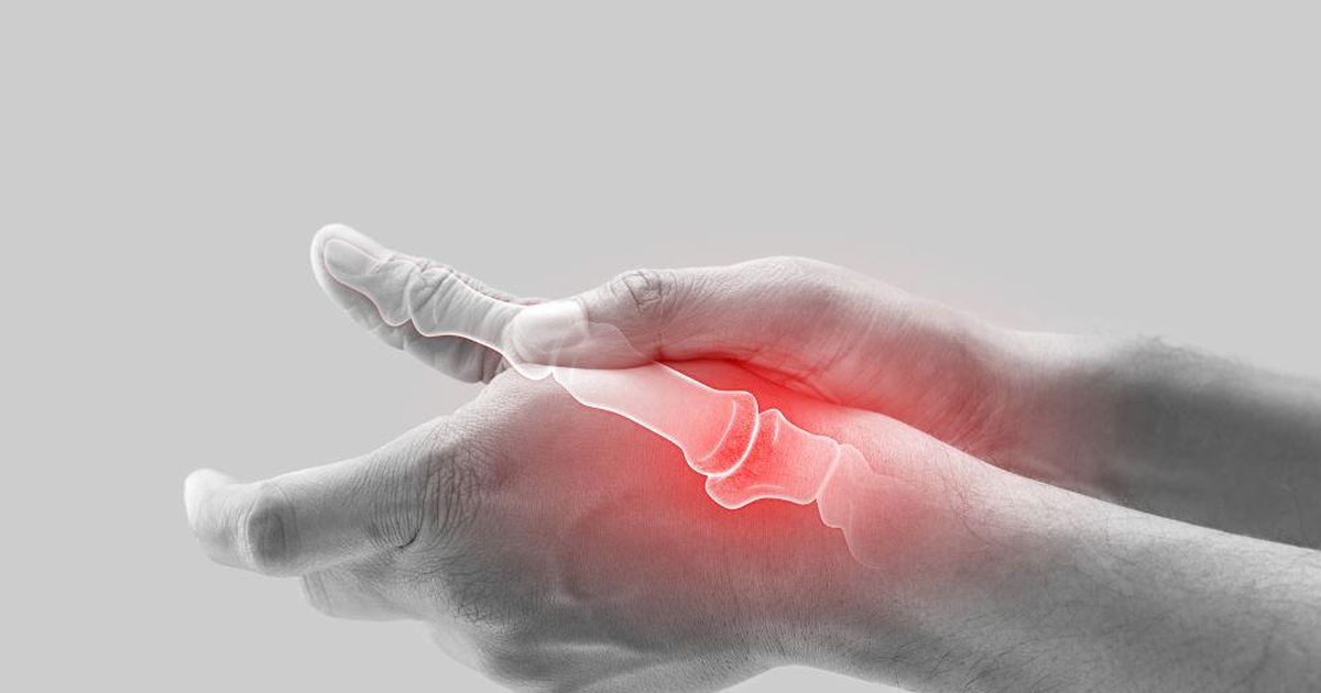 Revma v rokah: Kako pospešiti okrevanje? - Metropolitan.si